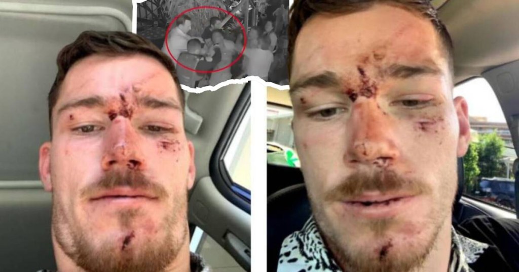 'I was scared': Raiders star opens up on terrifying ordeal as police ...